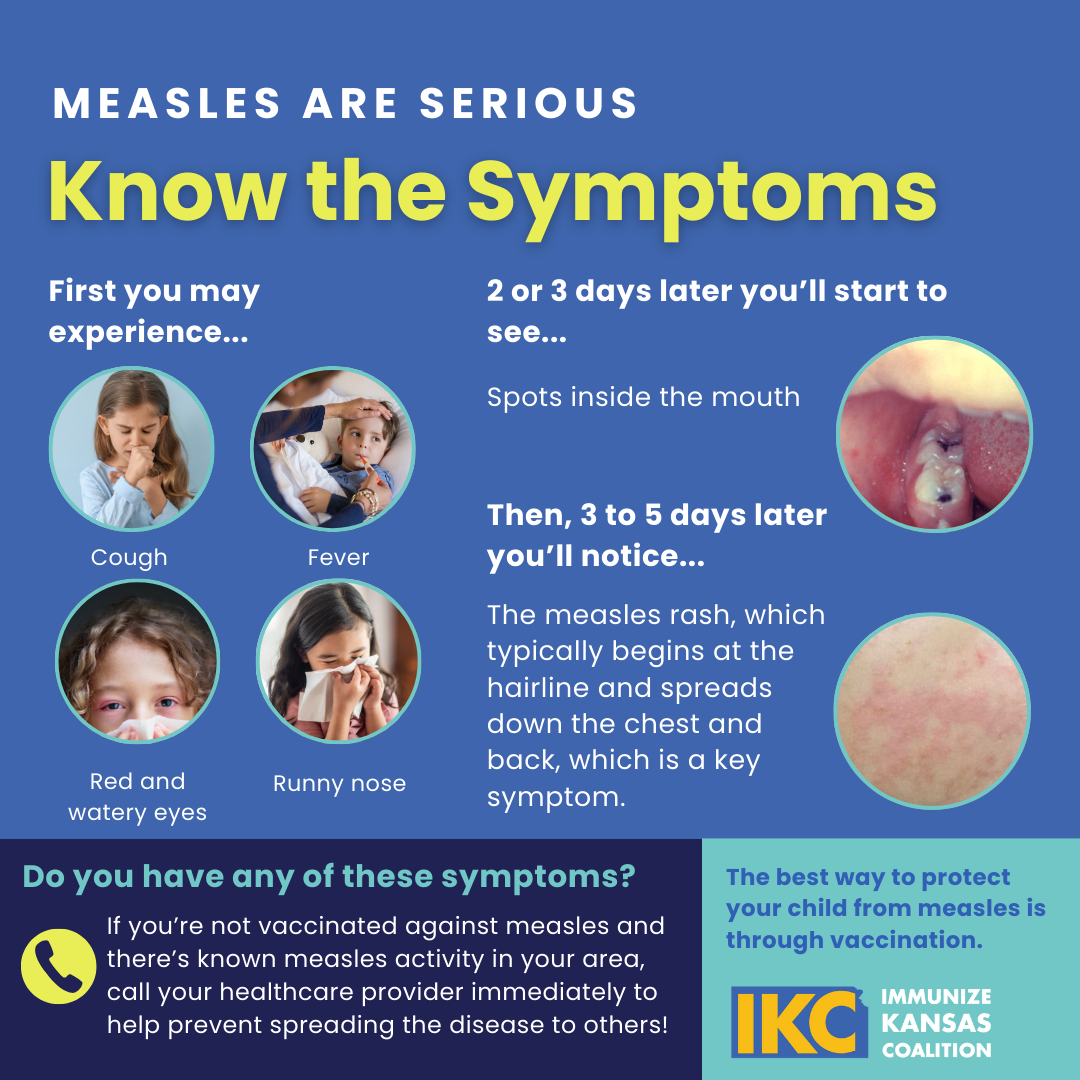Measles | IKC